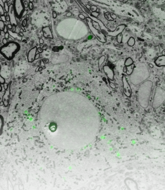 METEOR | Reduce transfer steps and improve sample yield with integrated cryo-CLEM